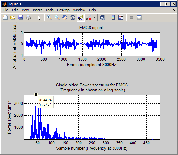 Biomedical Signal And Image Processing Projects Using Matlab And Labview Tools Matlab Code To