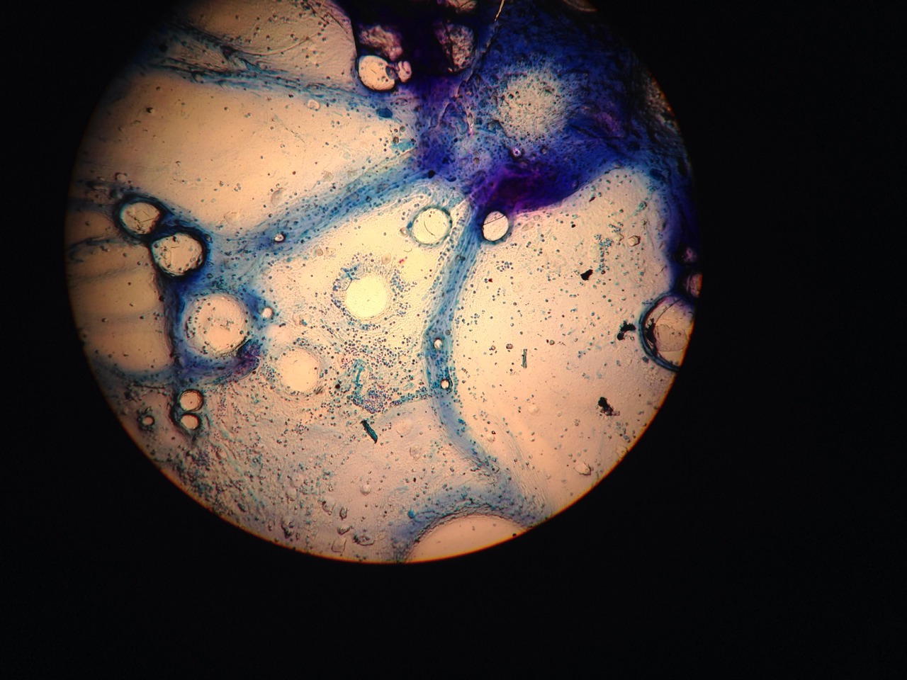 BAKTERI TAHAN ASAM (BTA) ~ Kumpulan Laporan Praktikum