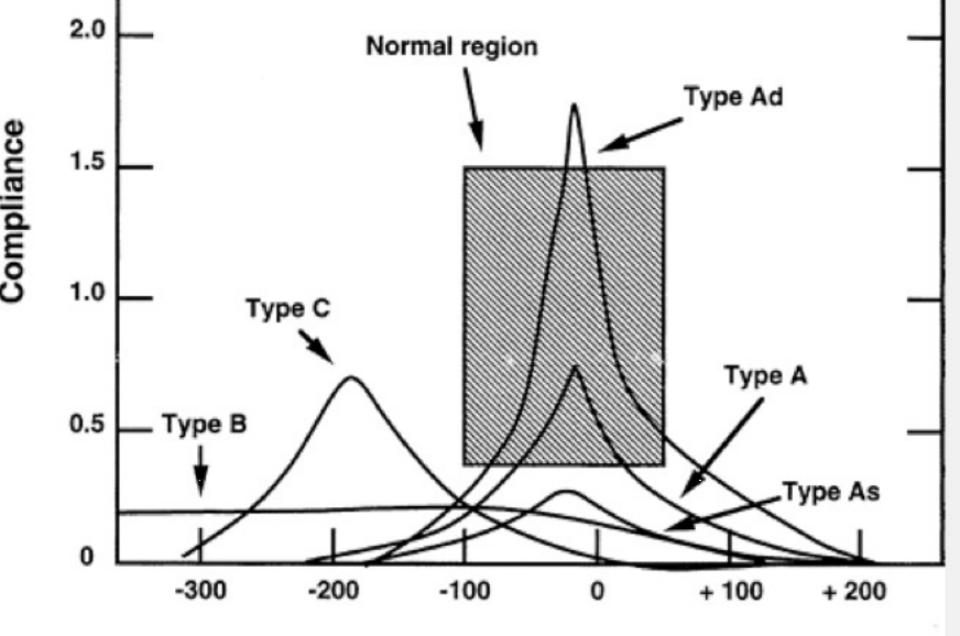 ODYOLOJİDE TEORİK VE PRATİK BİLGİLER: TİMPANOMETRİ (A,Ad,As,B,C,D,E ...
