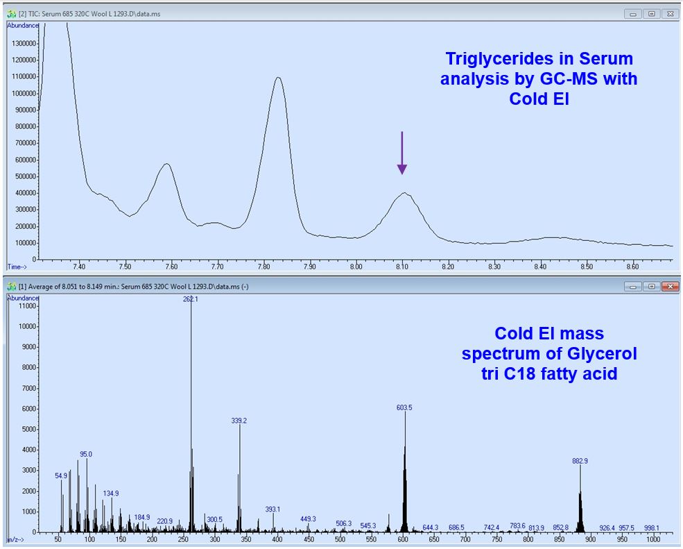 Advanced GC-MS Blog Journal: Lipids in Human Serum Analysis by the 5975 ...