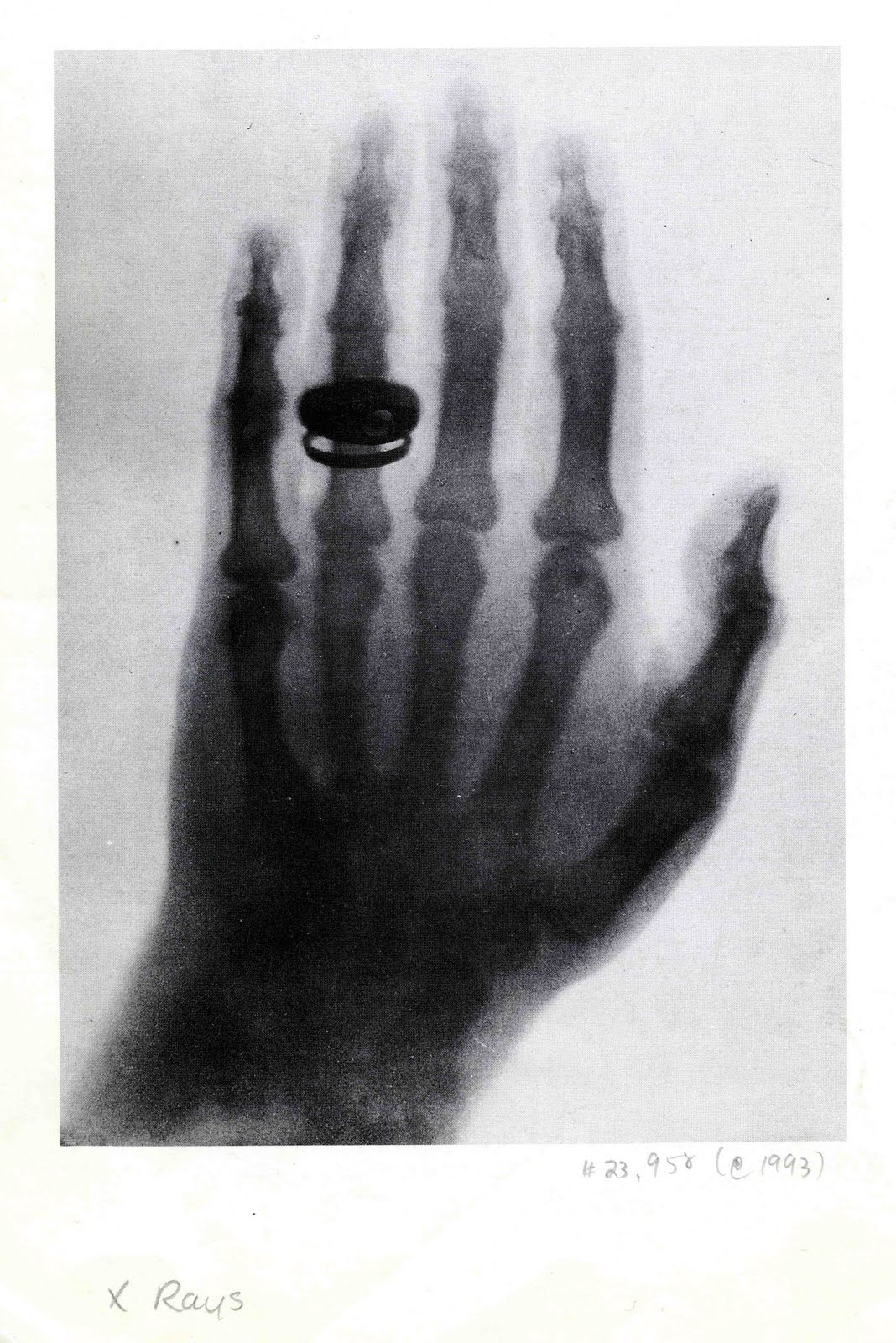 A is for Aye-Aye: An Abecedarian Adventure: The Romance of Roentgen: X ...