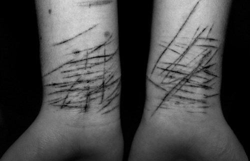 Mutilation - JungleKey.fr Image