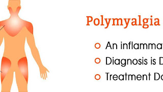 Polymyalgia rheumatica
