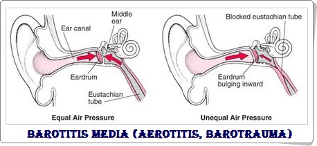 Fisiología del ejercicio : Tema 6: Ejercicio físico en diferentes tipos ...