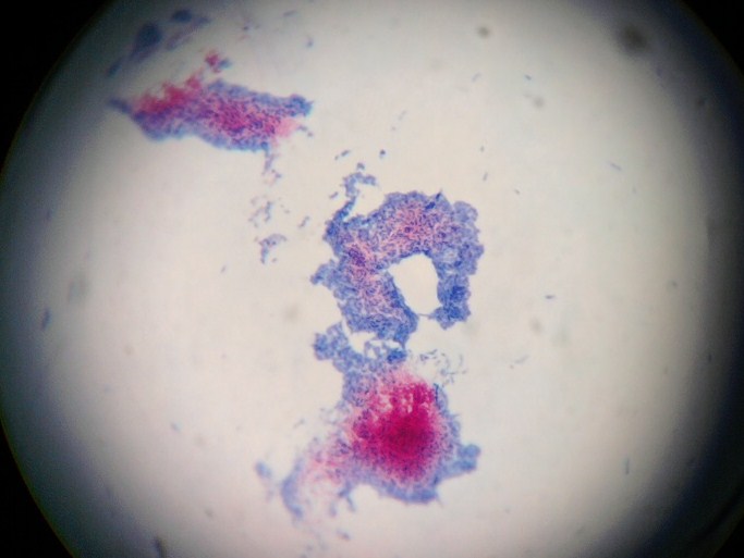 HicksMicro COURTESY Learning AID!: ACID FAST 8/22/22