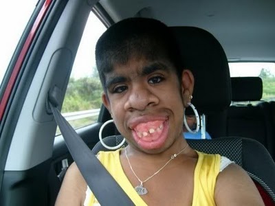 Fotos Do Homem Mais Feio Do Mundo