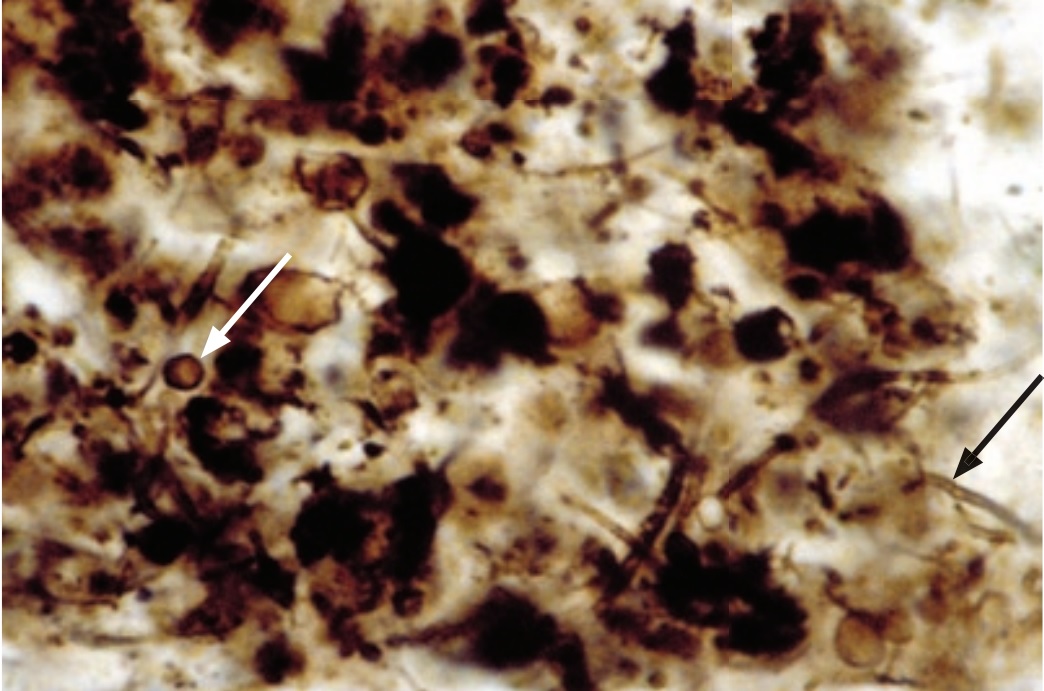 Learning Geology: Calcimicrobes/Cyanobacteria (Blue-green Algae)