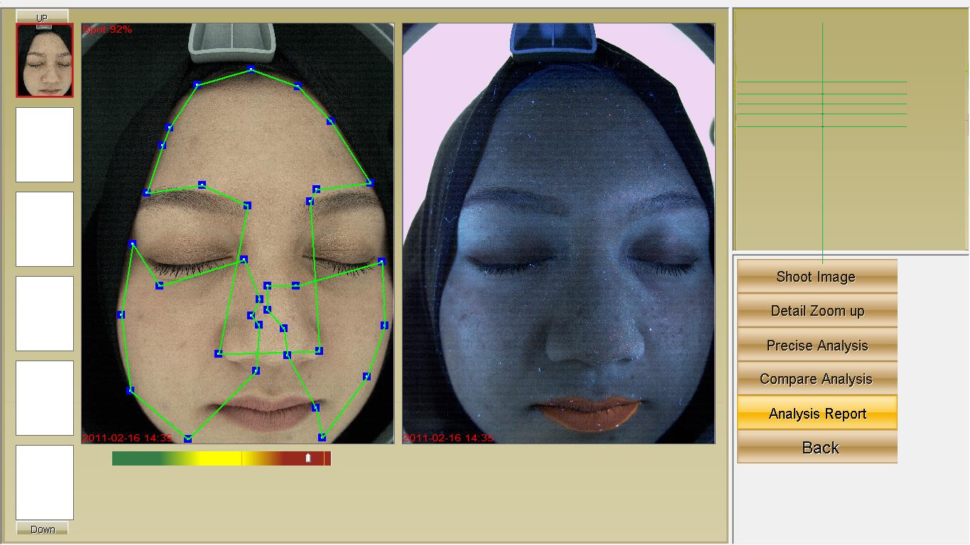 WAJAH TAMPIL VSHAPE DAN TEGANG DENGAN SEKALI RAWATAN