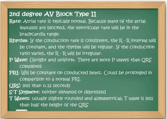 Basic Rhythm Review: Heart Blocks