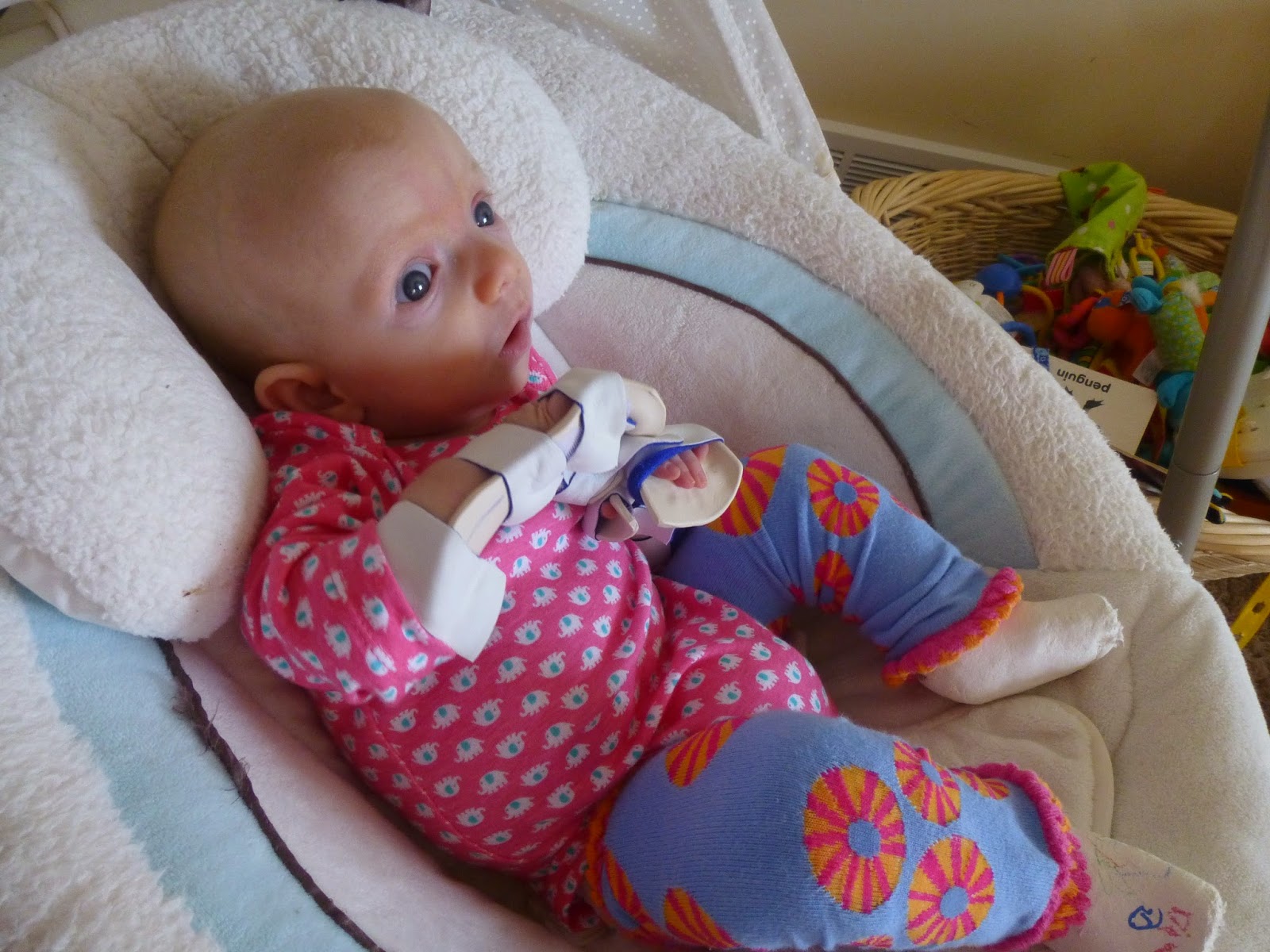 Amazing Amelia: What is arthrogryposis?