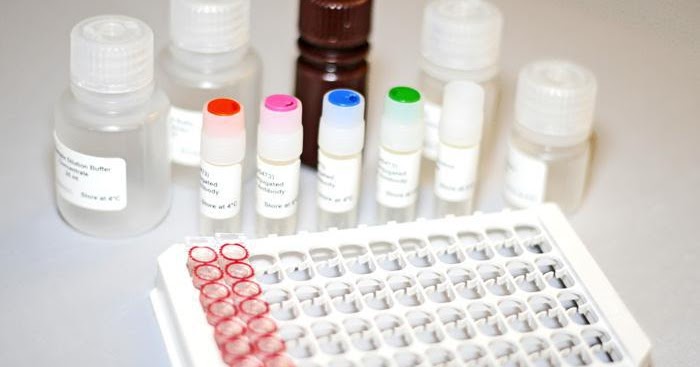 Assay Kits: Glucose Assay Kit