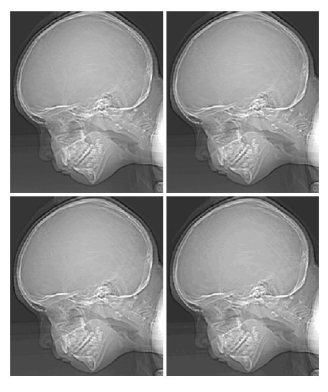 7. Define spatial and gray level resolution. Explain about ...