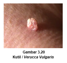 Anatomi Fisiologi Kulit, Materi Tata Kecantikan Kulit Kelas 10 SMK ...