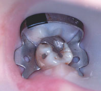 Dentistry and Medicine: Preparation of the Root canal System ...