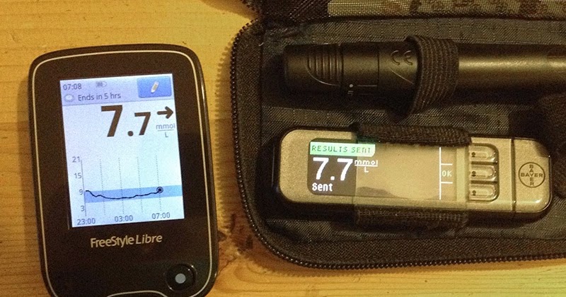 Every day ups and downs, a diabetes blog: Abbott Freestyle Libre ...