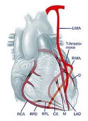Bypass Graft Conduit: Recommendations