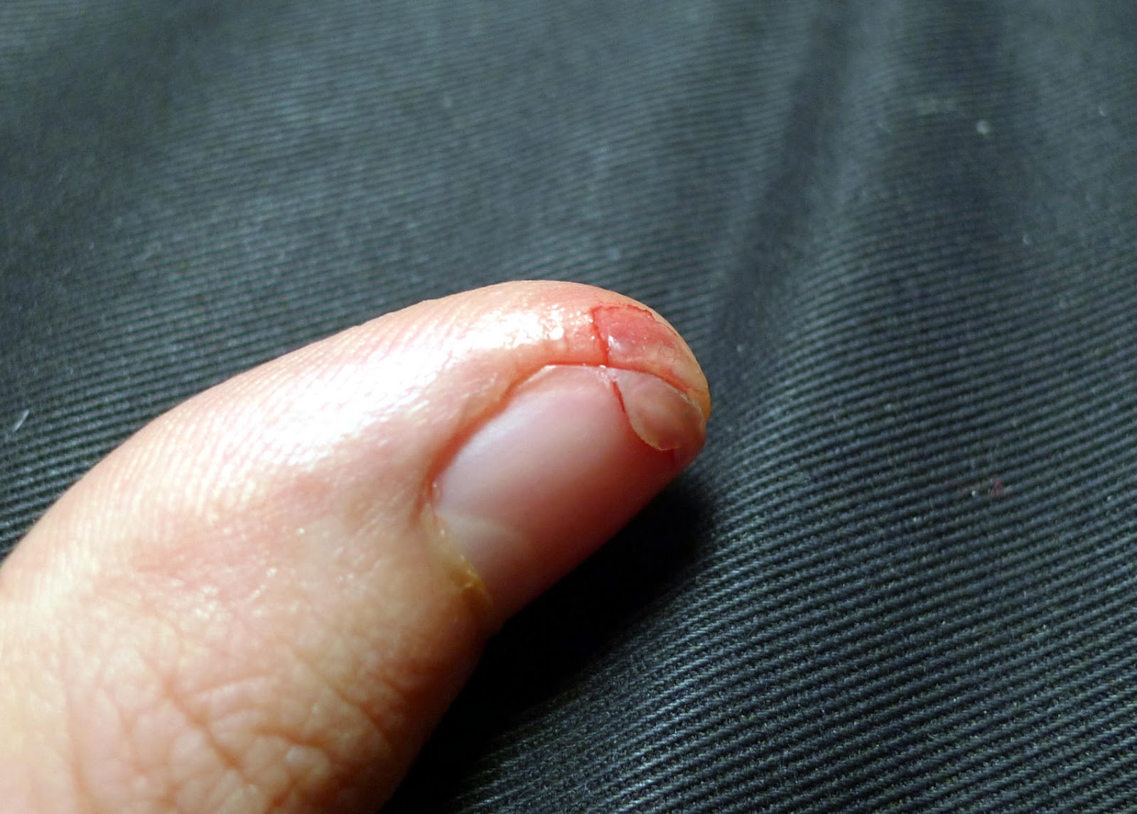 PISICI ŞI ZOMBIE: Bube taieturi juleala 23