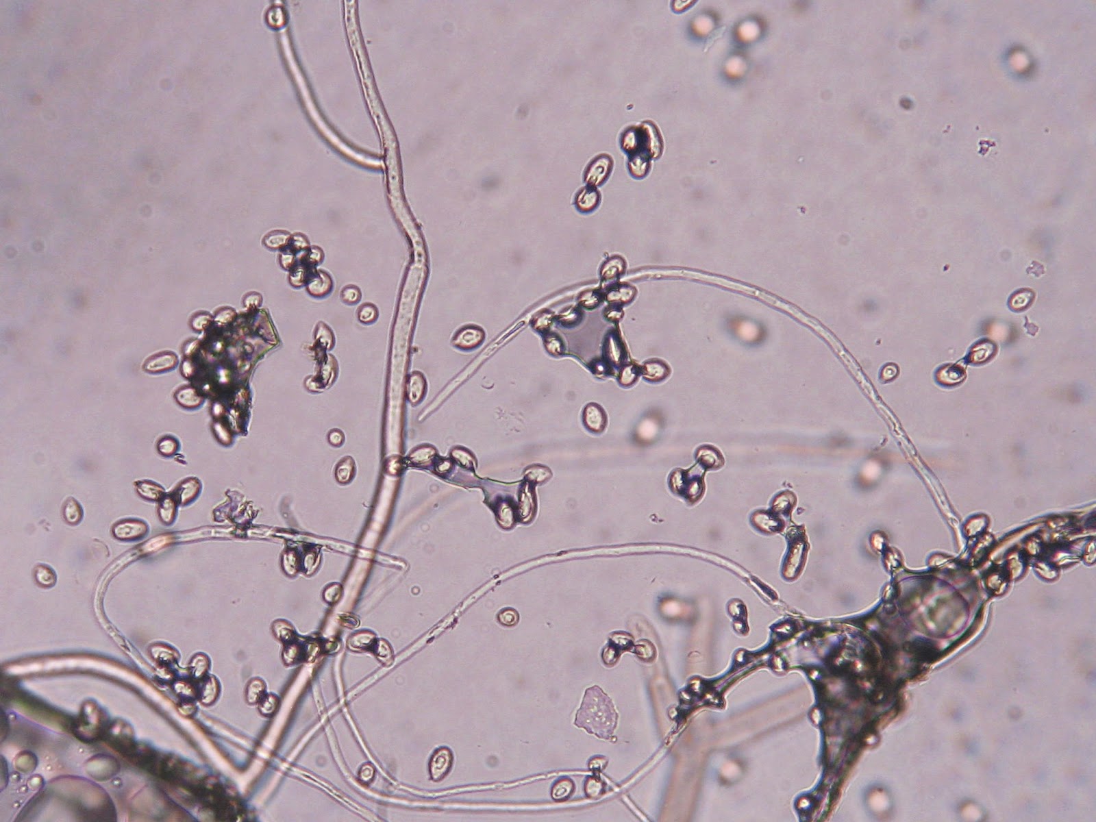 TAMU_PLPA631_FungalBlog_LornaNissen: Lab 6