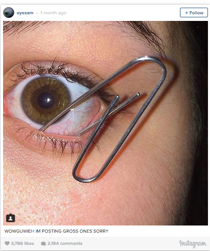 Eliora Gist Blog: New internet craze sees people sticking SAFETY PINS ...