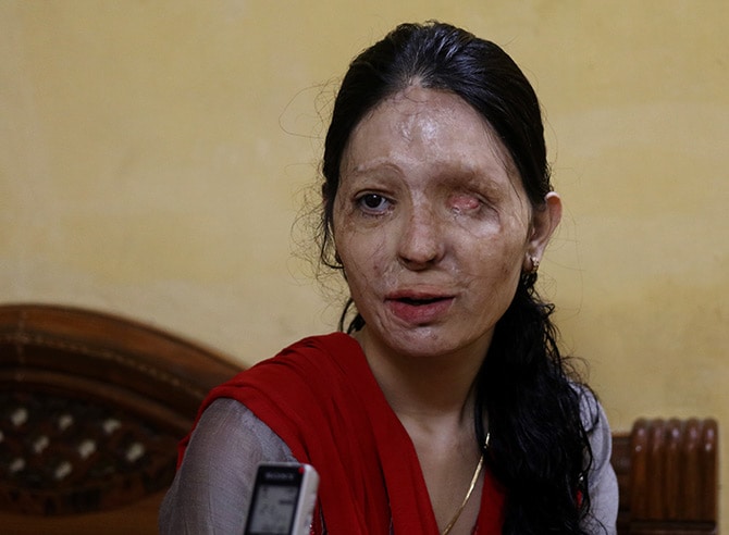 After Having Acid Poured On Face, Woman Defies Odds And Shows True ...