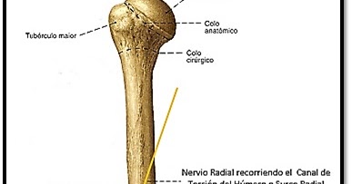 Lesión del Nervio Radial - Radial Nerve Palsy: QUÉ ES UNA LESIÓN DEL ...