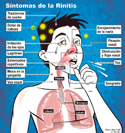 LA RINITIS