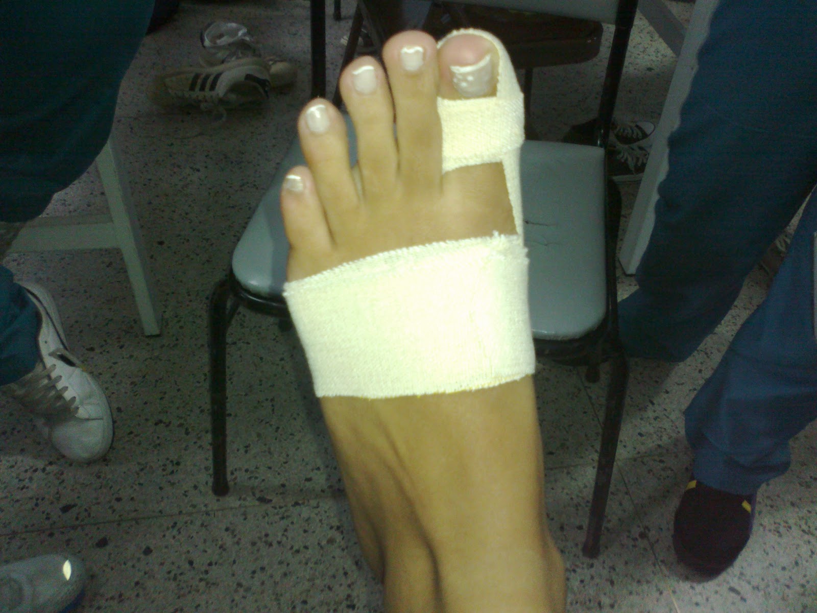 Vendajes Funcionales