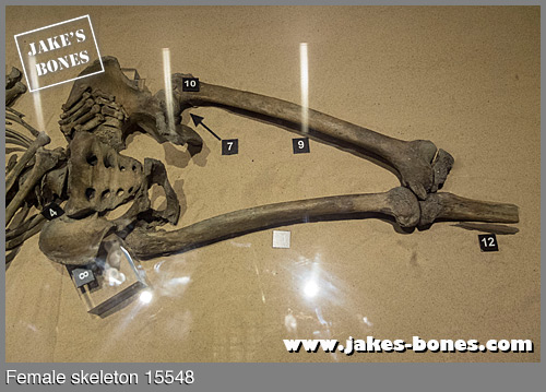 The Viking skeletons at Jorvik : Jake's Bones