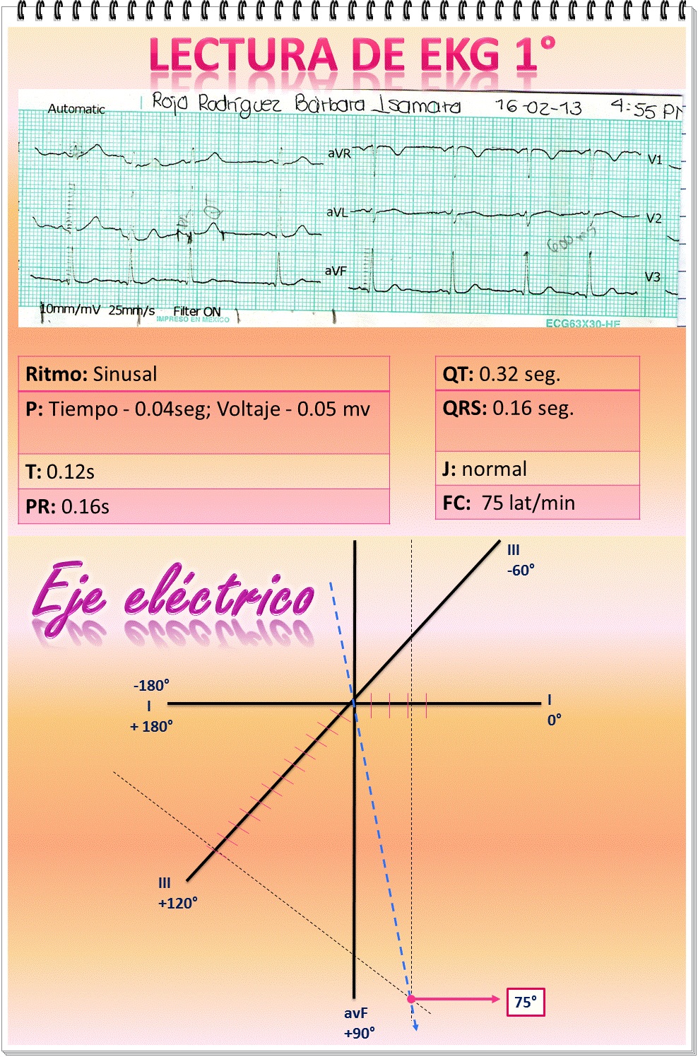 Fisiología humana: Lectura de electrocardiogramas