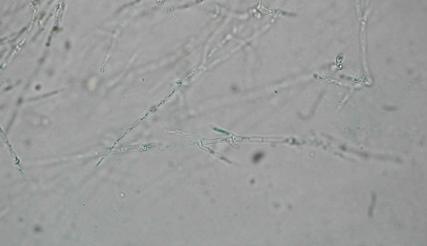 ATLAS MICOLOGIA: TRICHOPHYTON SOUDANENSE