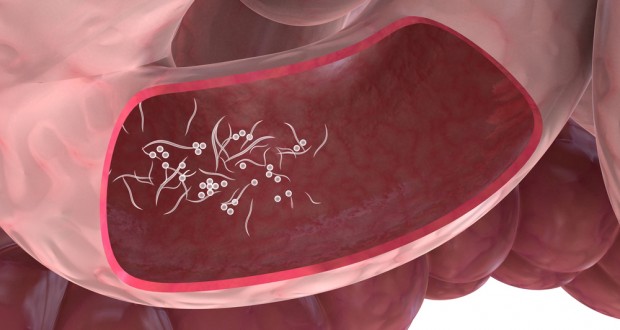 Gezondheidsweb: Ingewandswormen of aarsmaden