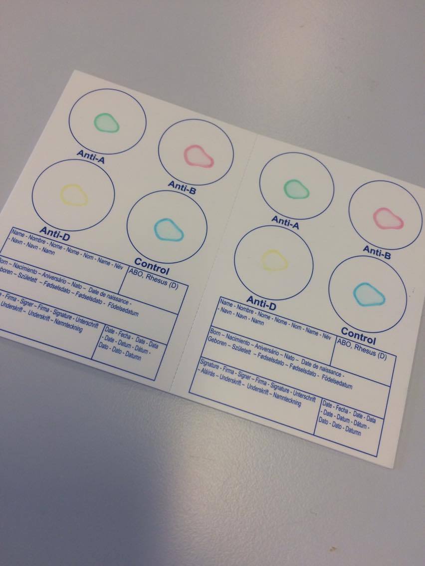 Naturfag med Andrine: Bestemmelse av blodtype med ELDON-kort.