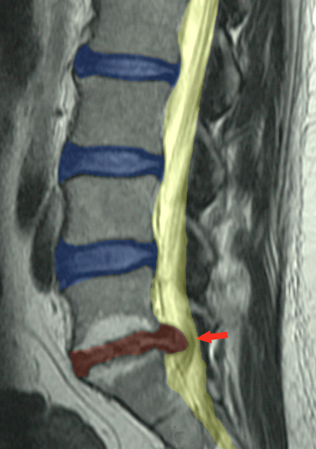 Welcome To John Boemihardjo's Blog: HNP