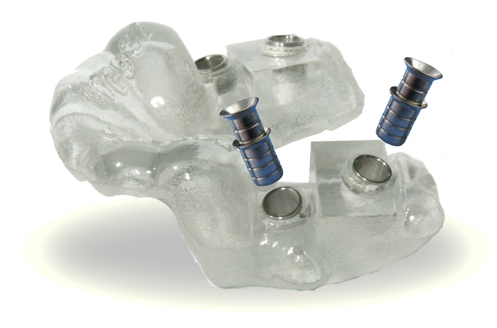 Dental Implant Surgical Guide Sleeves at Walter Mcglothlin blog