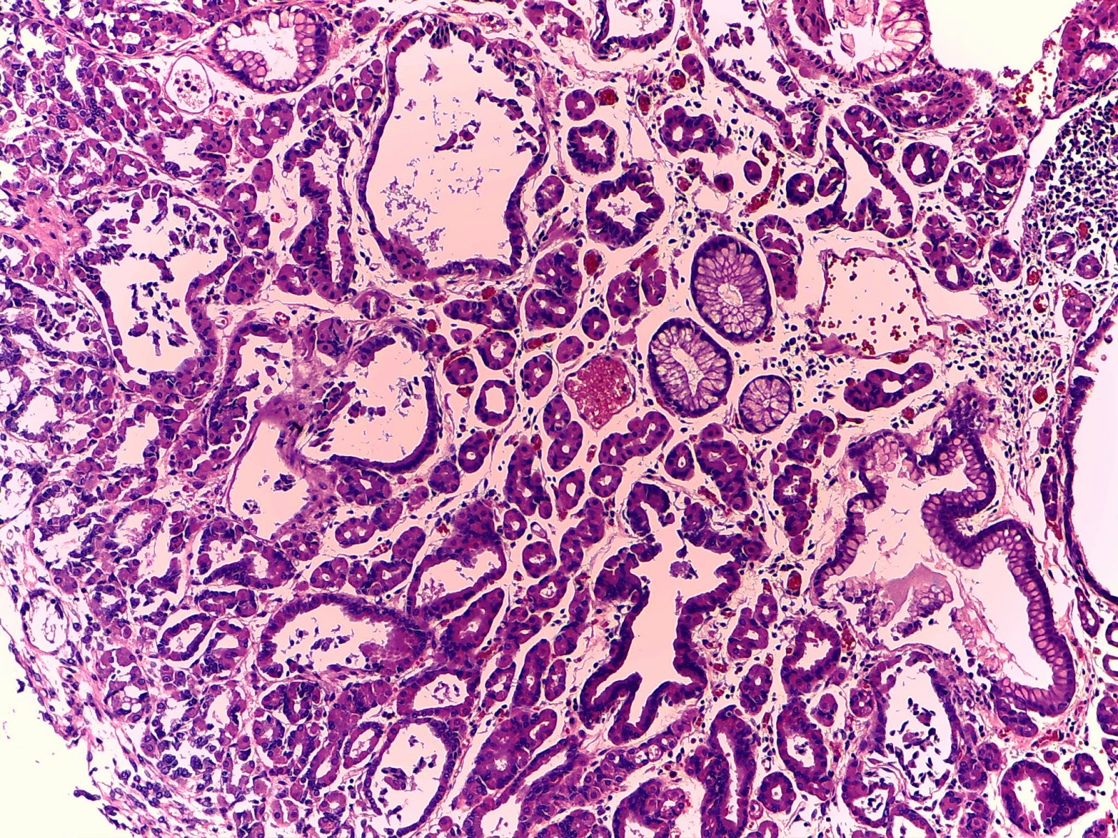 GASTROINTESTINAL AND LIVER HISTOLOGY PATHOLOGY ATLAS: STOMACH: FUNDIC ...