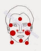 AL JANNAH PUSAT RAWATAN BEKAM DAN AKUPUNTUR KELANTAN: PAKEJ RAWATAN ...