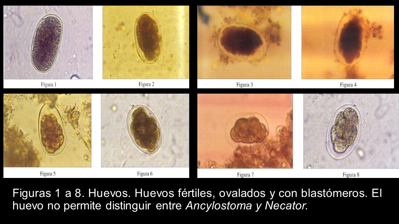 Microbiología: UNCINARIAS/ NECATOR AMERICANUS