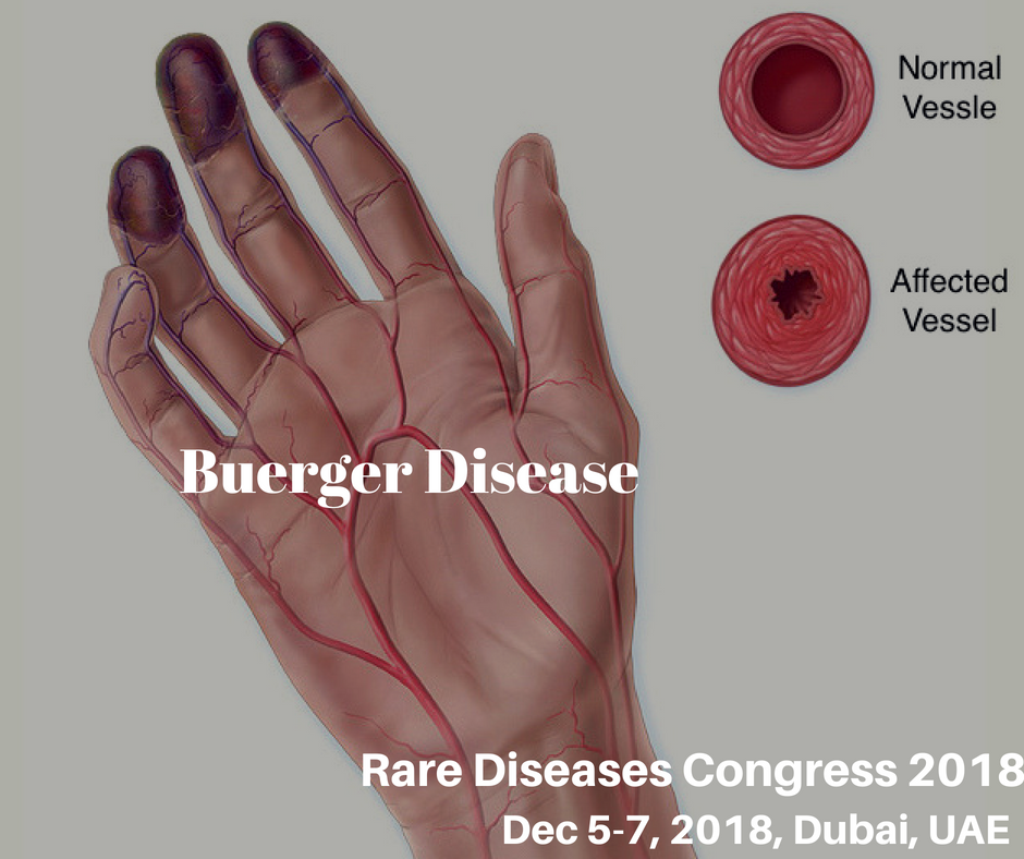 Rare Blood Diseases rare-blood-diseases