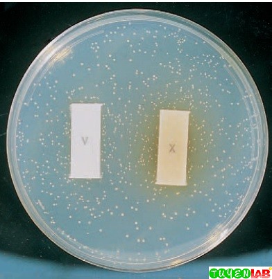 [Microbiology] Atlas of Haemophilus and Other Fastidious Gram-Negative ...