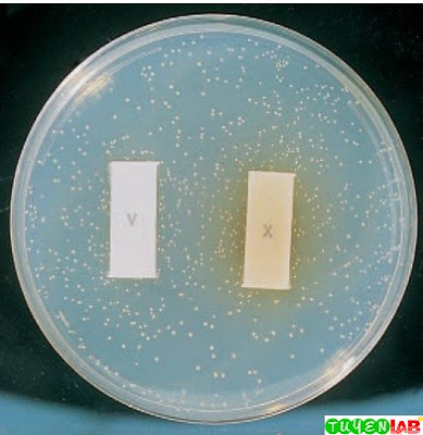 [Microbiology] Atlas of Haemophilus and Other Fastidious Gram-Negative ...