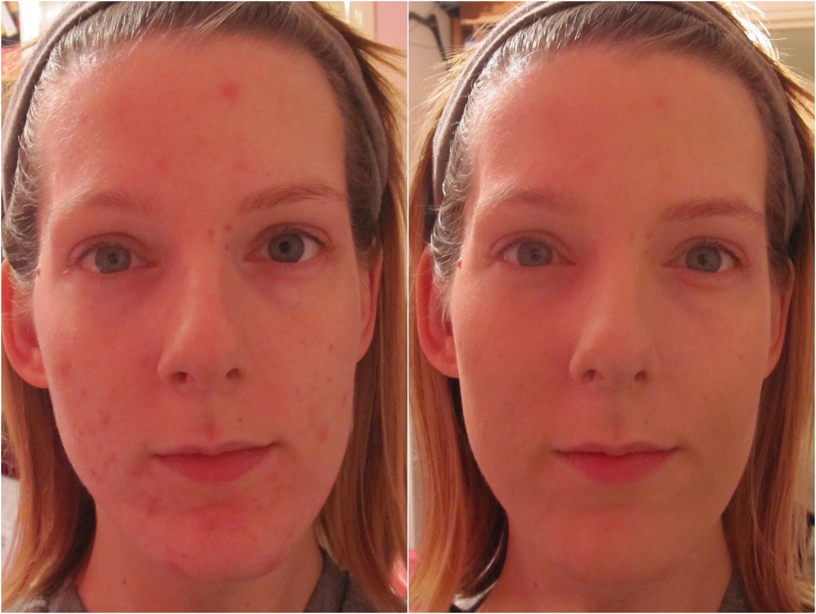 High Coverage Products and How to Use Them - Beauty Geek