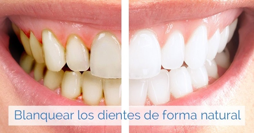 Pasta dental casera para blanquear los dientes y eliminar las caries ... Pasta dental casera para blanquear los dientes y eliminar las caries ...