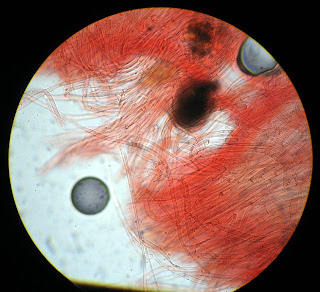 The Mycelium Connection: Fungal Word Friday: Clamp Connection