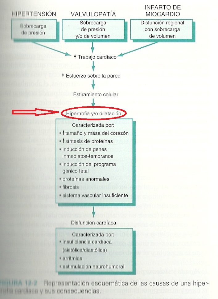 Patología : HIPERTROFIA CARDÍACA, una "mala adaptación"