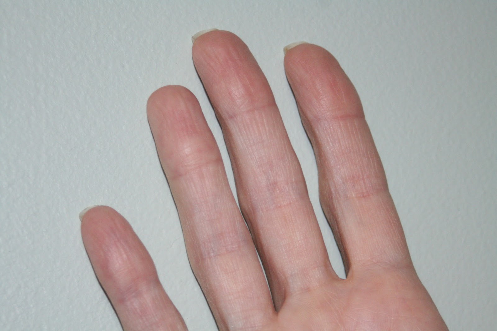 Lusukat Could A Person Have No Fingerprints lusukat-could-a-person-have-no-fingerprints