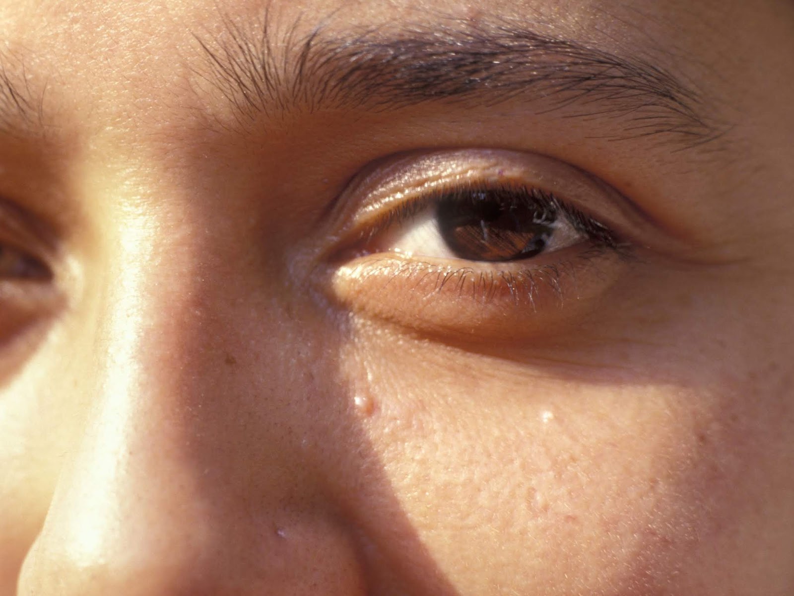 Spôsobujú obyčajné krémy mílie? - Recenzie kozmetiky