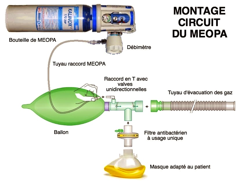 Le MEOPA | Récap' IDE
