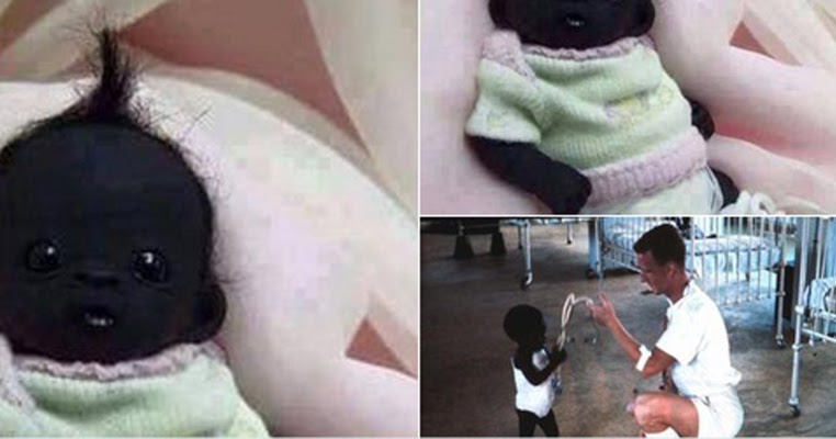 Get ready for surprise: Meet The Darkest Baby in The World