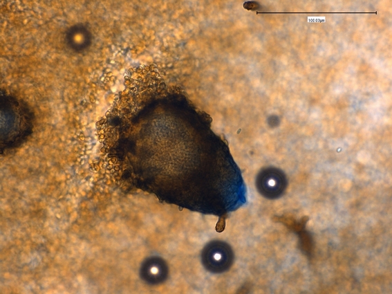 Fun With Microbiology (What's Buggin' You?): Phoma glomerata