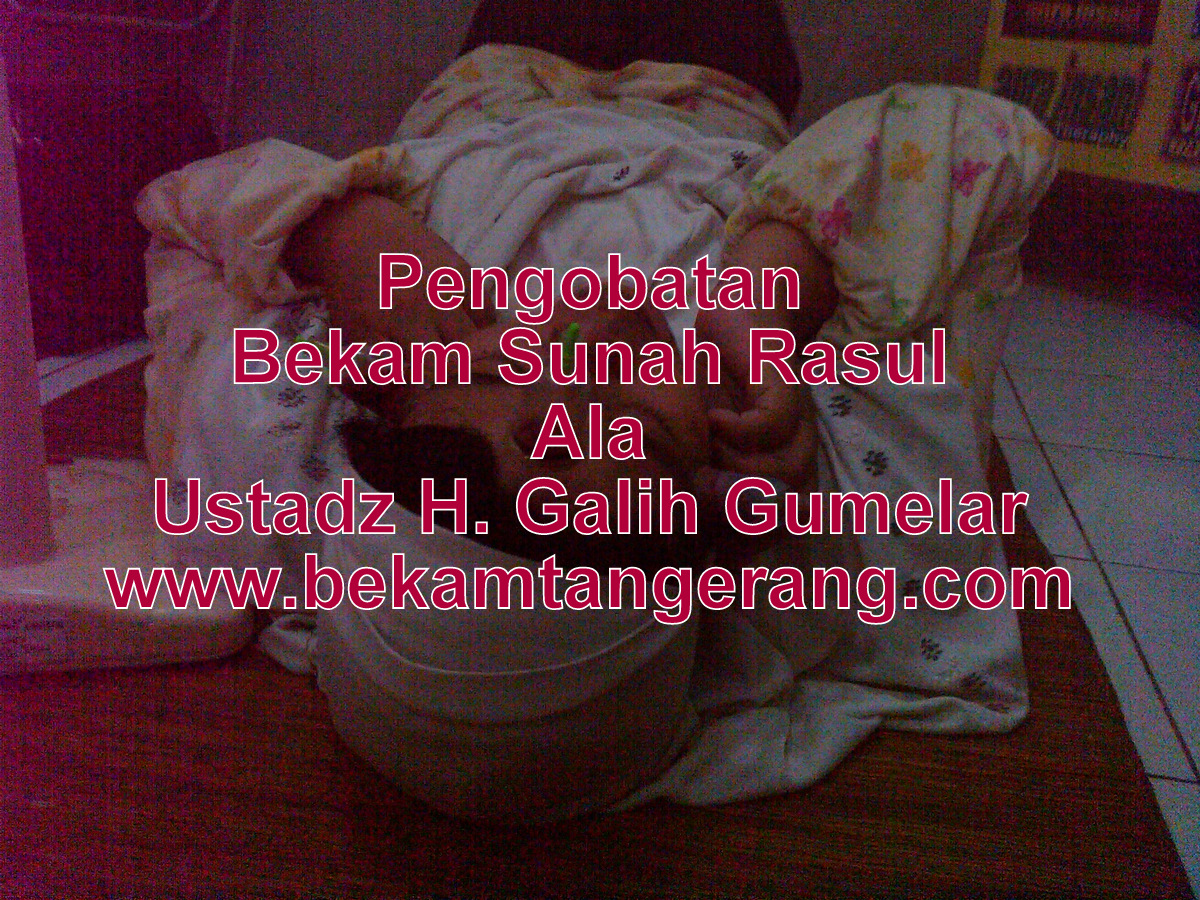 Metoda Bekam Api - Galih Gumelar